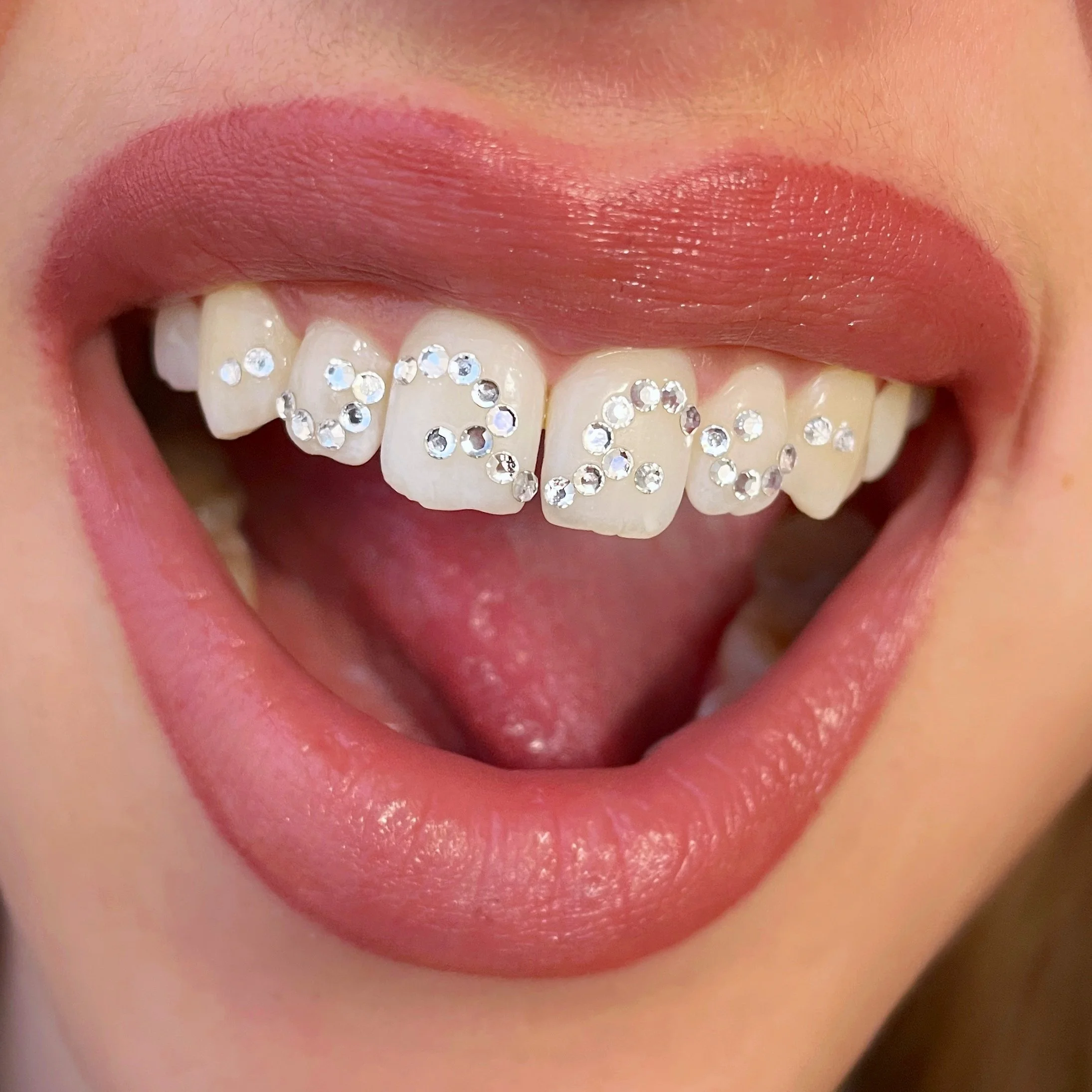 Sia Icy - Tooth Gem Kits