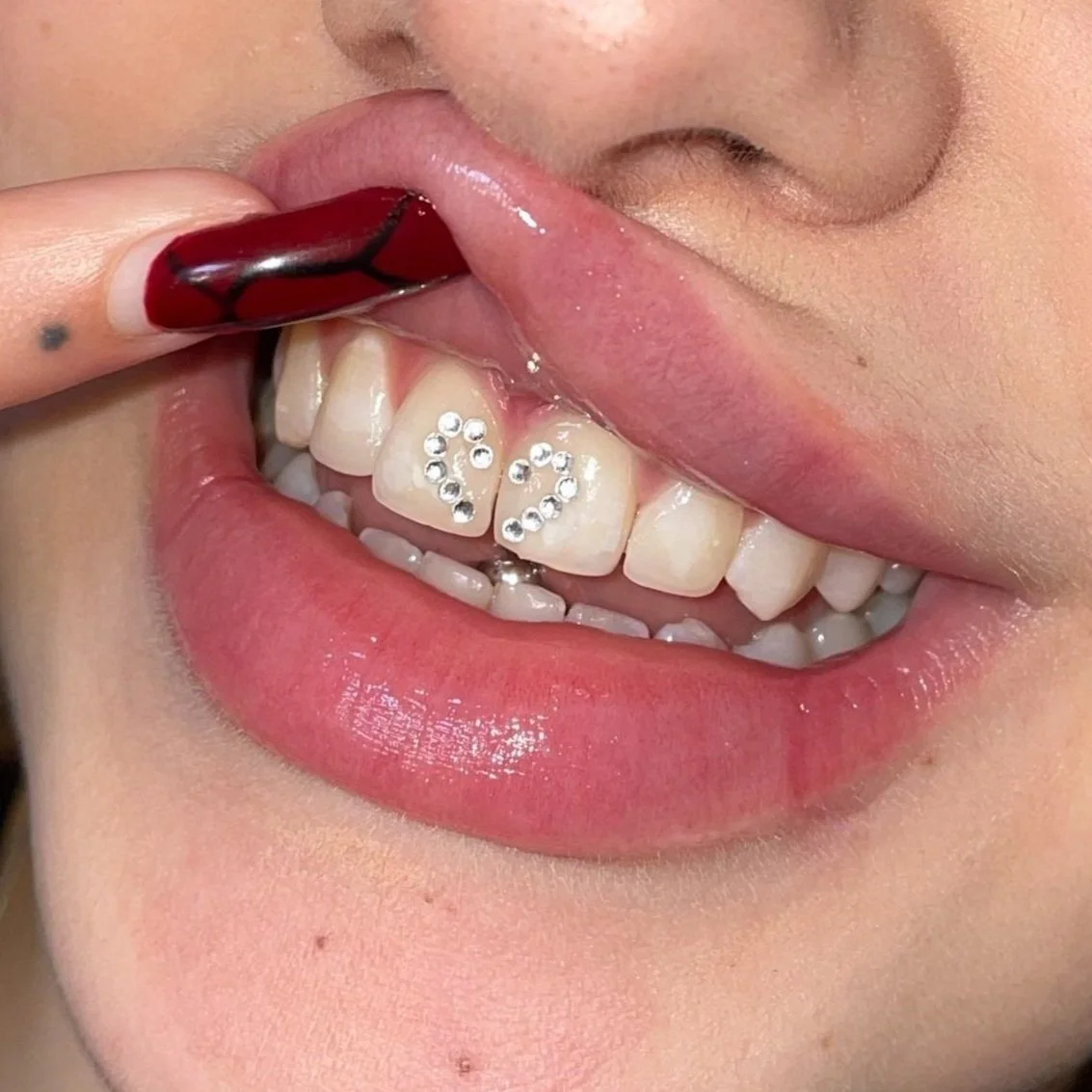 Sia Icy - Tooth Gem Kits