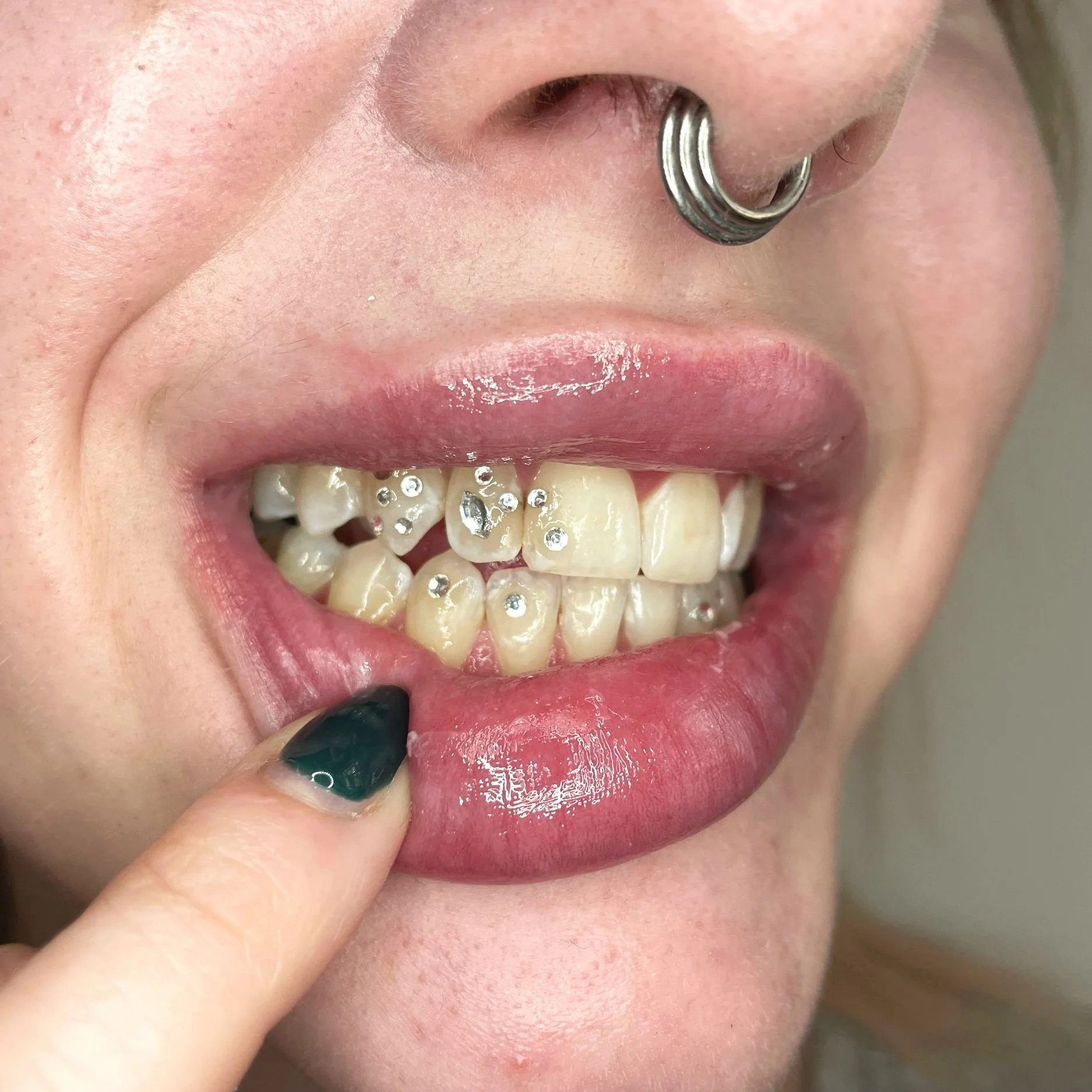 Sia Icy - Tooth Gem Kits