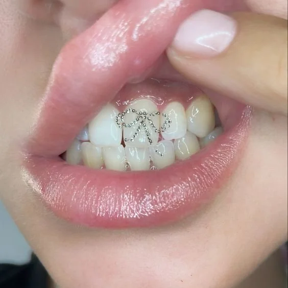 Sia Icy - Tooth Gem Kits