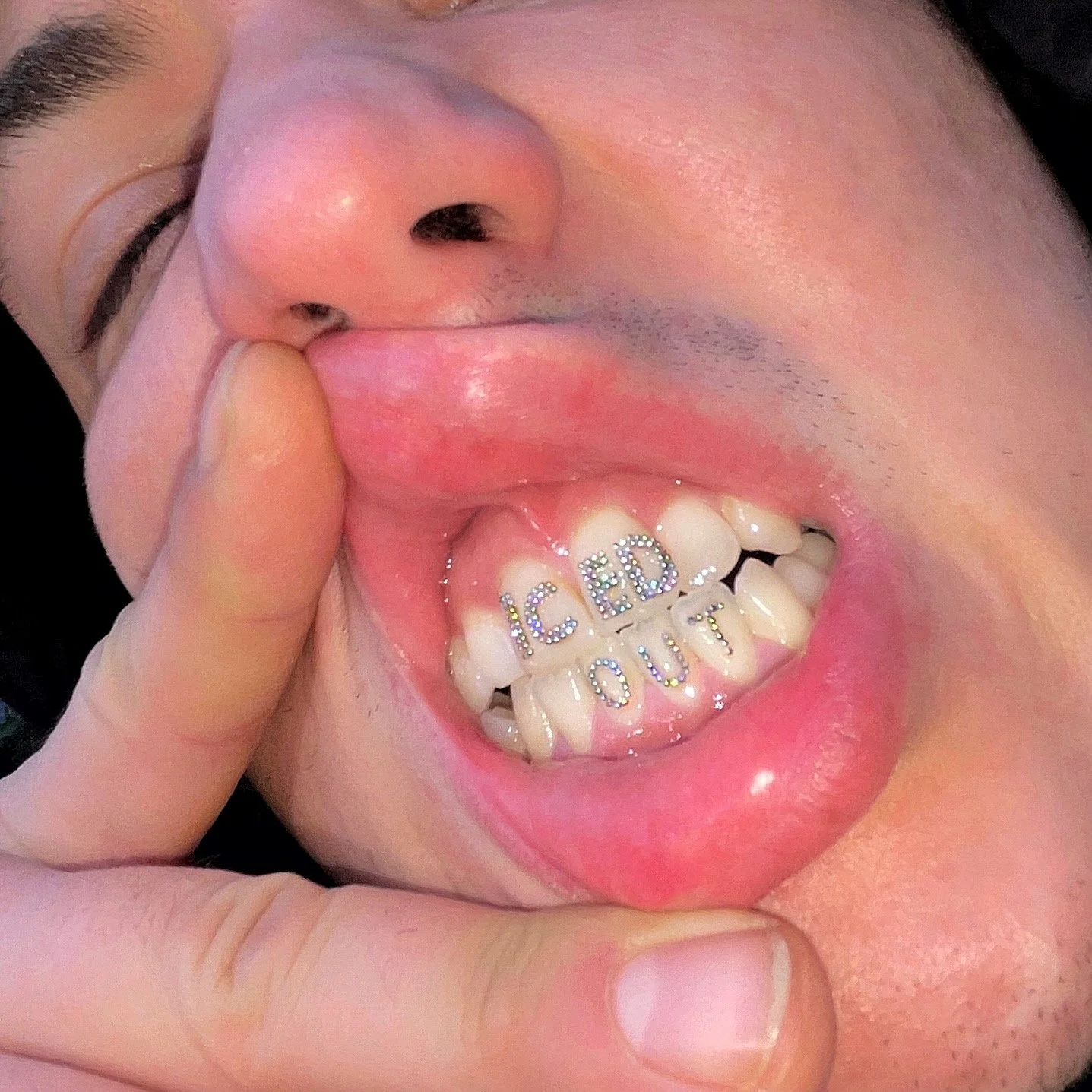 Sia Icy - Tooth Gem Kits