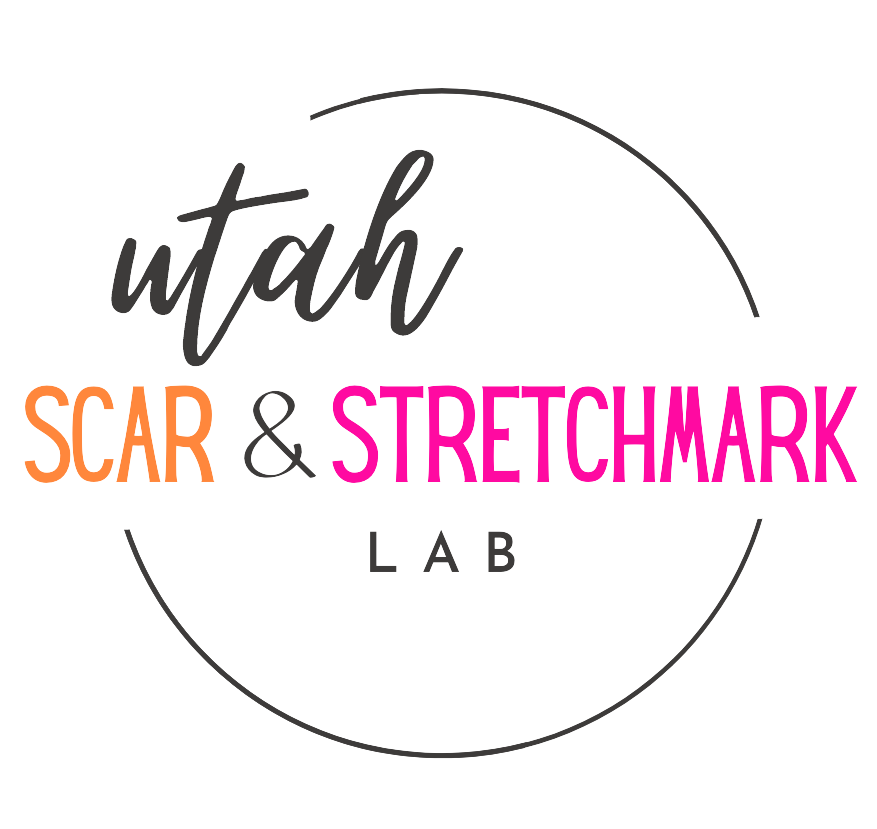 Camouflage Scar and Stretch Mark Tattoo. Scars, tummy tuck, surgical ...