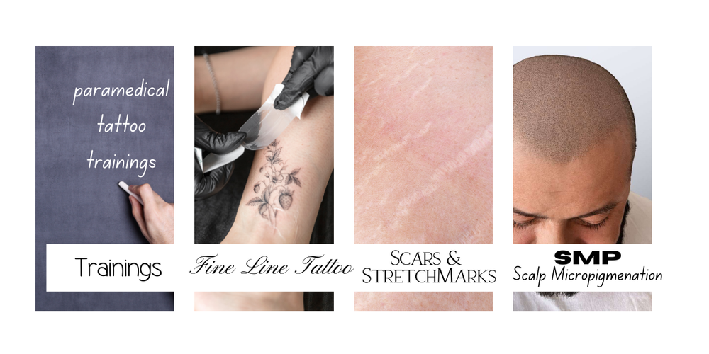 Camouflage Scar and Stretch Mark Tattoo. Scars, tummy tuck, surgical ...