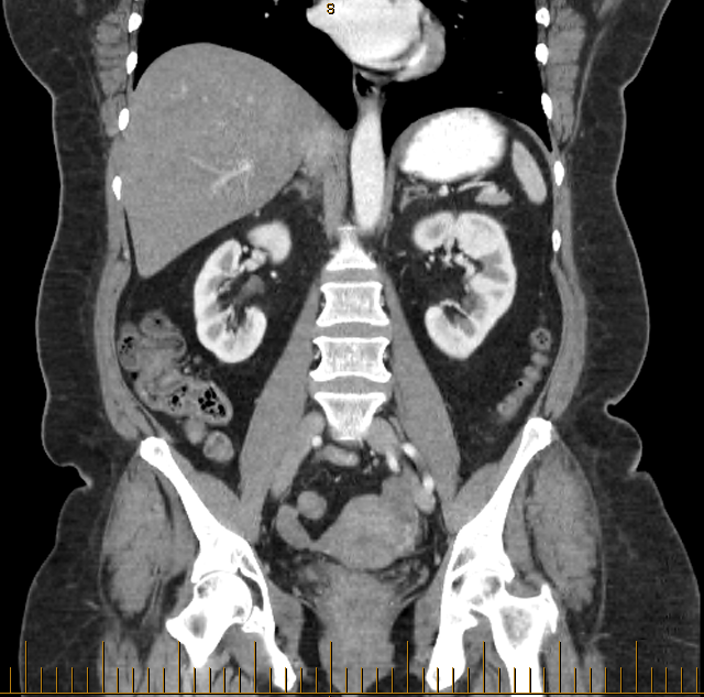 CT Services in Midland, TX — NuChoice Imaging