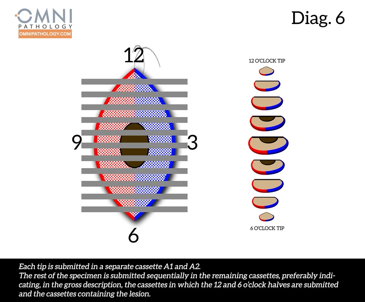 HOW TO GROSS AN ORIENTED SAMPLE — OmniPathology