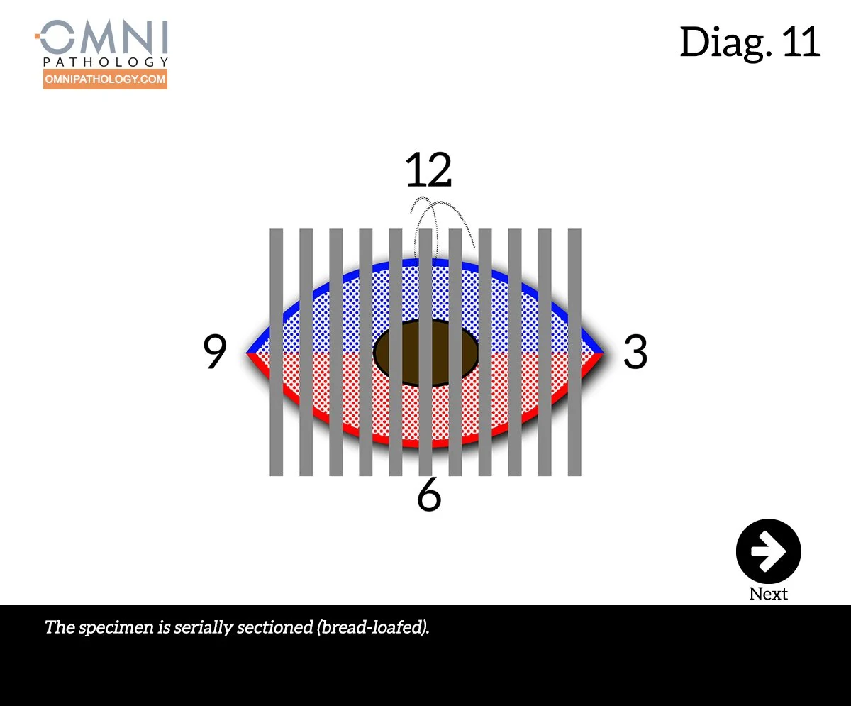 HOW TO GROSS AN ORIENTED SAMPLE — OmniPathology