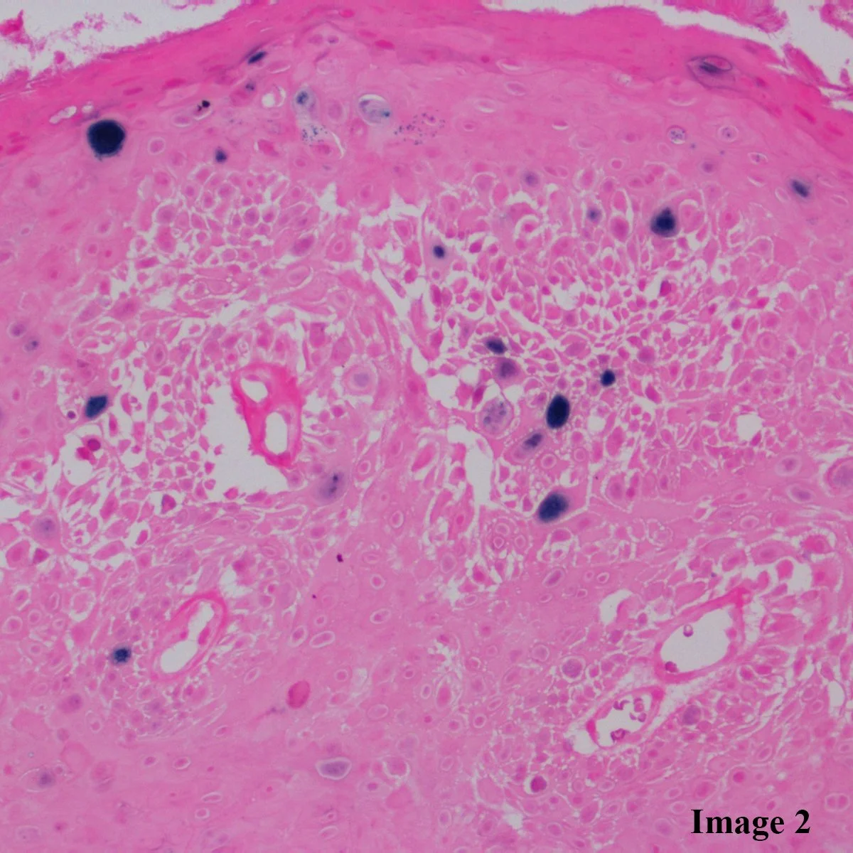 Oral HPV Testing: A New Dental Approach to an Old Problem — OmniPathology