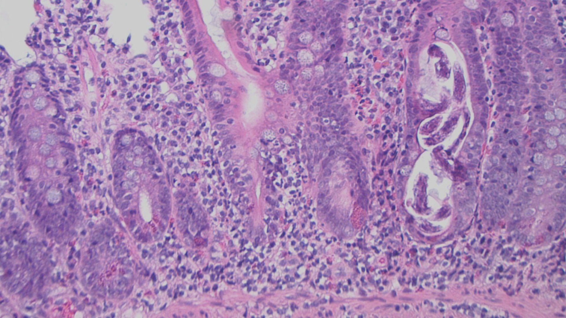 Filmarray GI Panel — OmniPathology