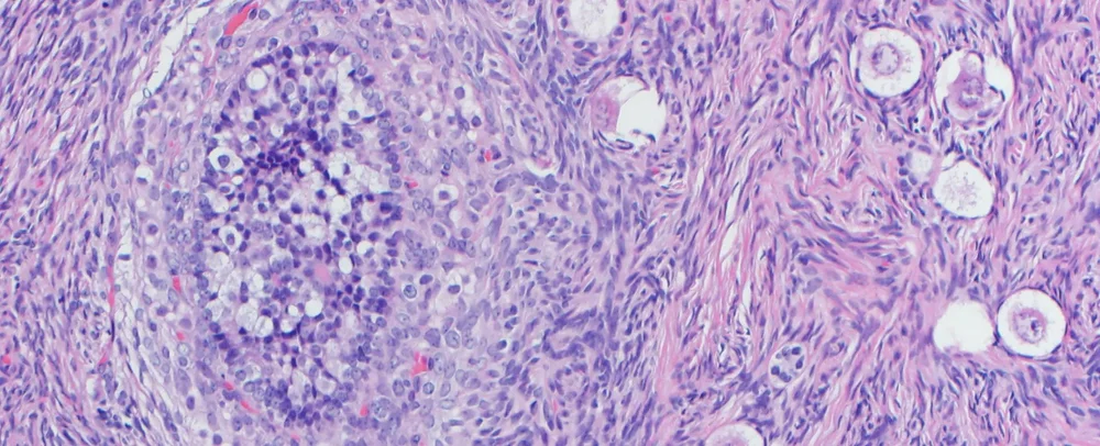 Omni GYN Pathology Program — OmniPathology