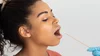 Oropharyngeal HPV Testing for Dentists & Healthcare Providers ...