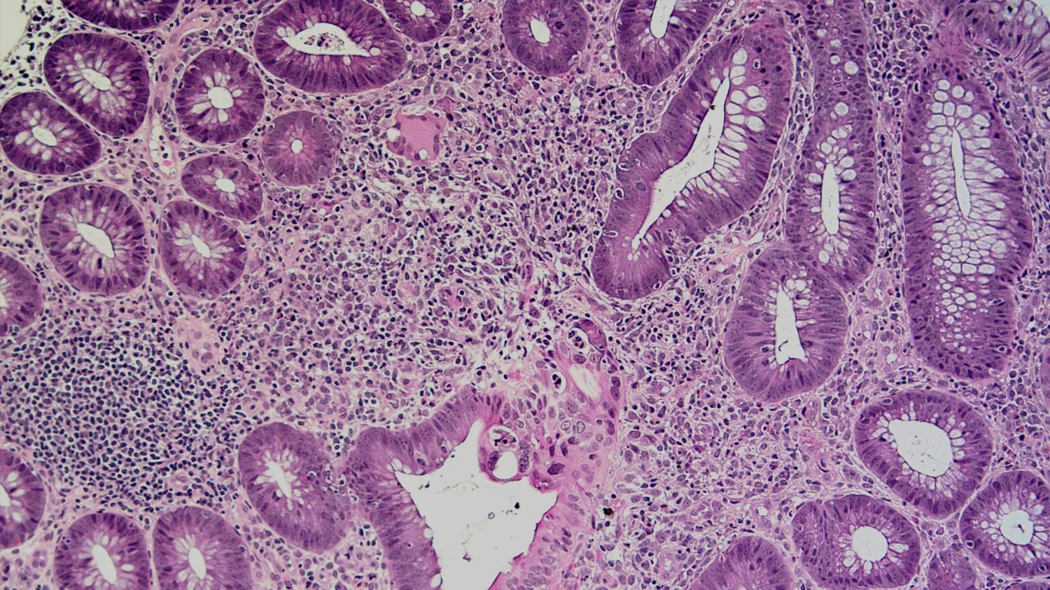 GI Pathology — OmniPathology