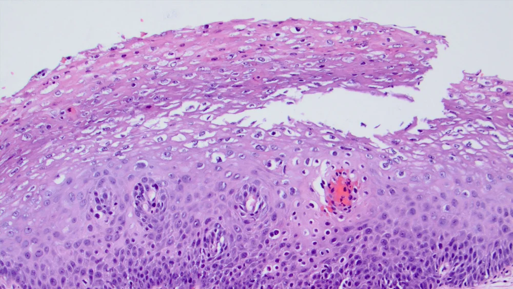 Gynecological Pathology — OmniPathology