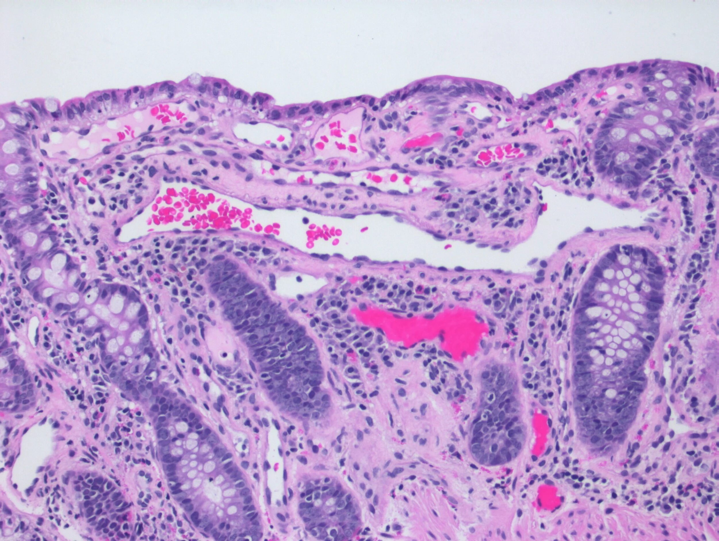 CASE STUDY #1 — OmniPathology