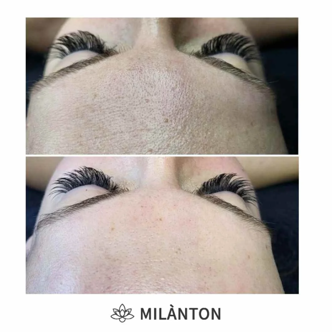 Zemits HydroVerstand — Milanton Group Belgique