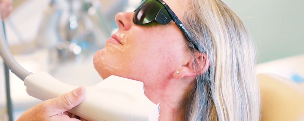 The Truth About Laser Hair Removal And PCOS — New Image Laser Skin Center