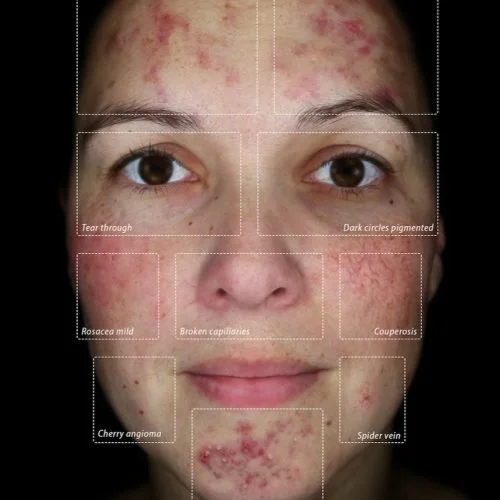 Advanced Cosmetic Clinic, Sydney: Injectables, Laser, Skin