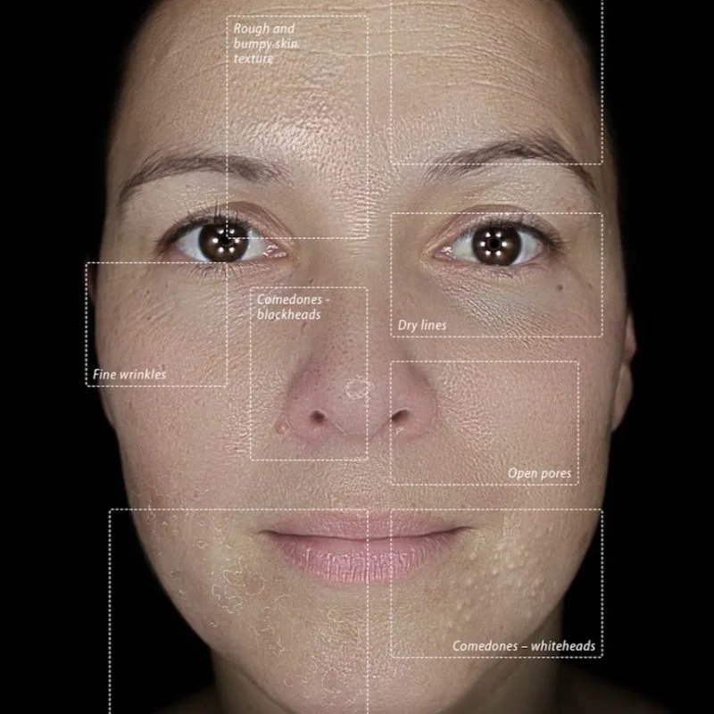 Advanced Cosmetic Clinic, Sydney: Injectables, Laser, Skin