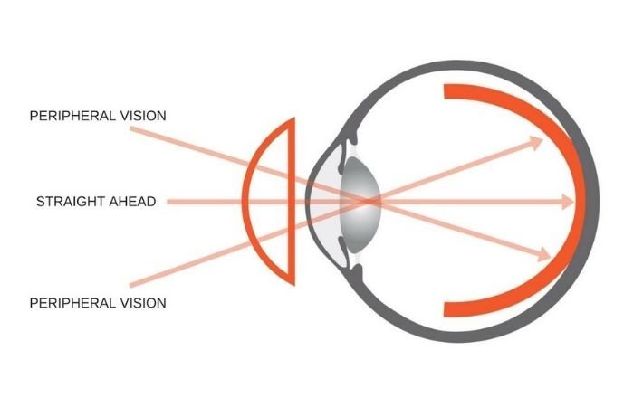 MiYoSmart Lenses: A Breakthrough in Myopia Control for Kids MiYoSmart Lenses: A Breakthrough in Myopia Control for Kids