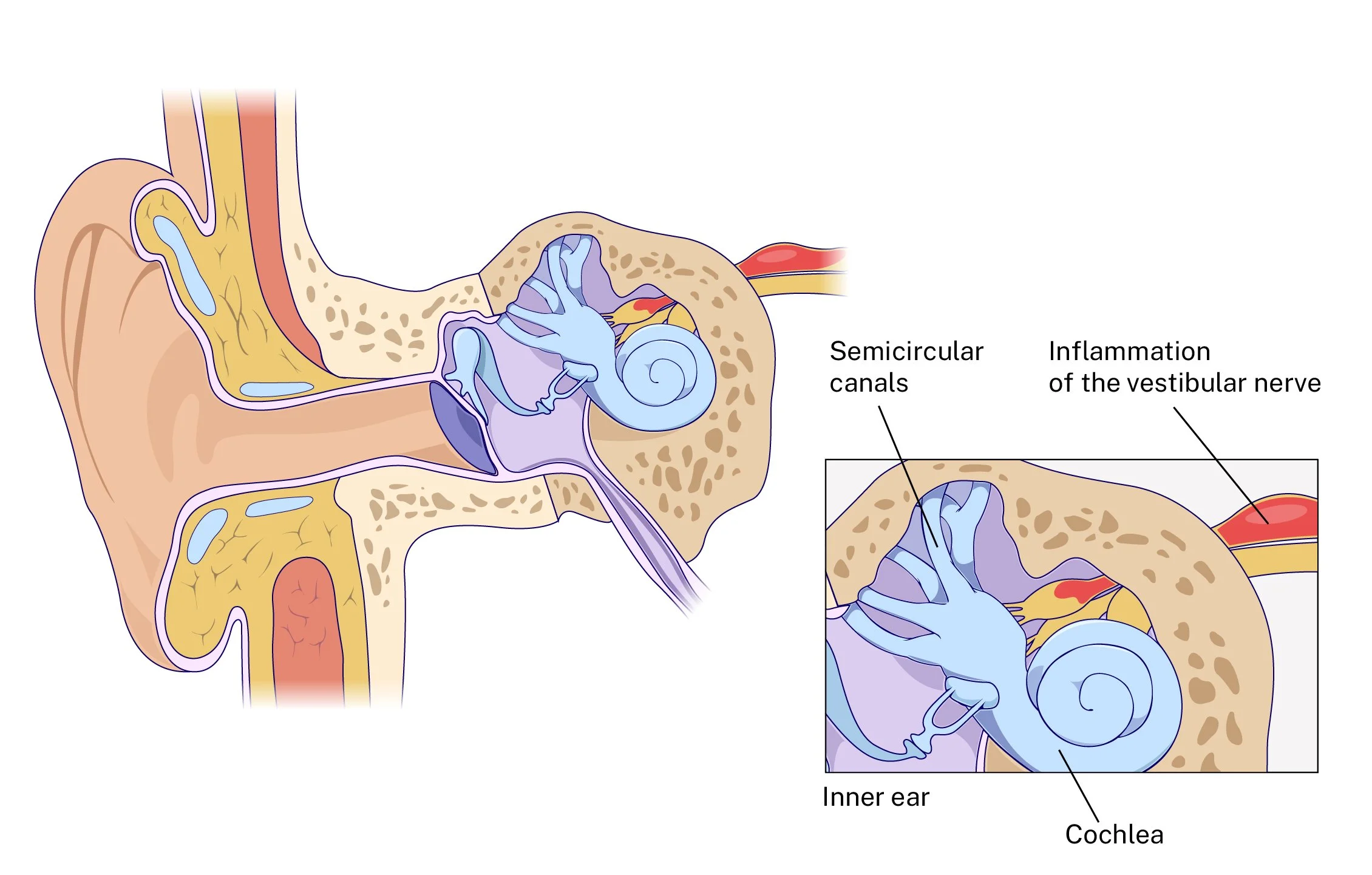 Vestibular | Vertigo Physio Near Me | Neuritis Treatment