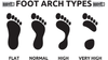 High-Arched Feet (Pes Cavus) Canberra: Symptoms, Gait & Posture ...