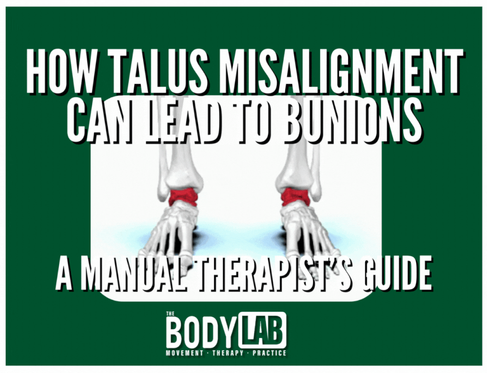 How Talus Misalignment Causes Bunions: Manual Therapy Insights | Feet ...