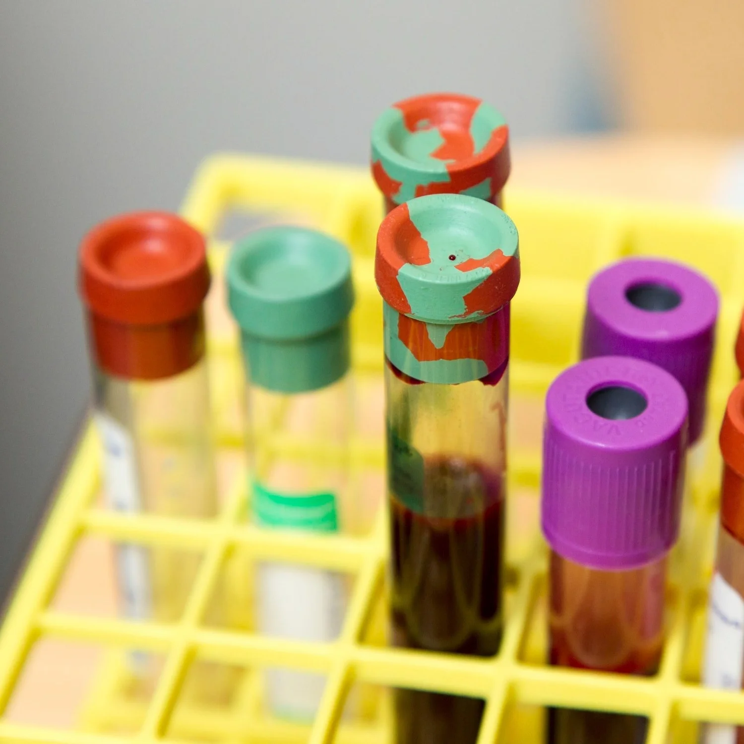 Paradise Valley Heart and Rhythm - Jeffrey Munro DO - Cardiac ...