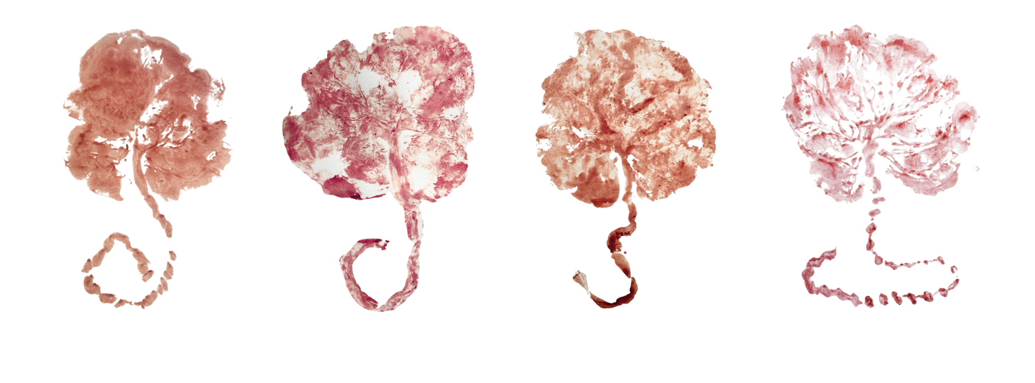 Placenta Encapsulation Perth | Since 2012, Dual-Certified, Insured ...