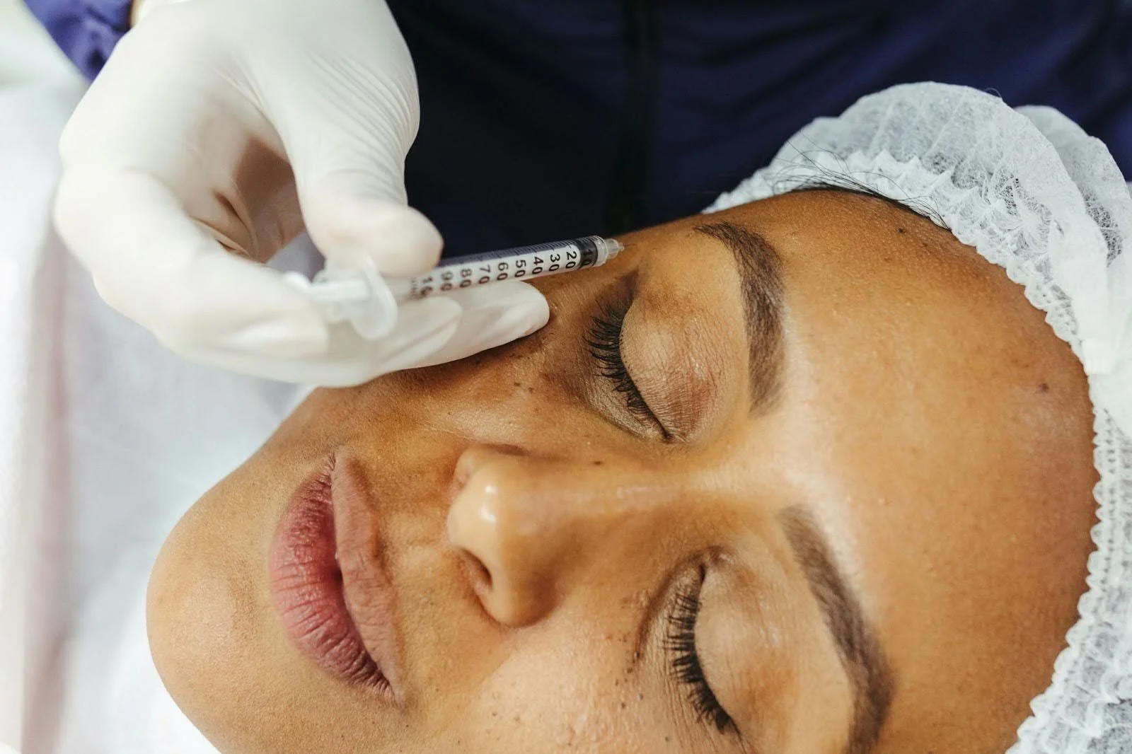 Botox 101: Everything You Need to Know Before Your First Appointment ...