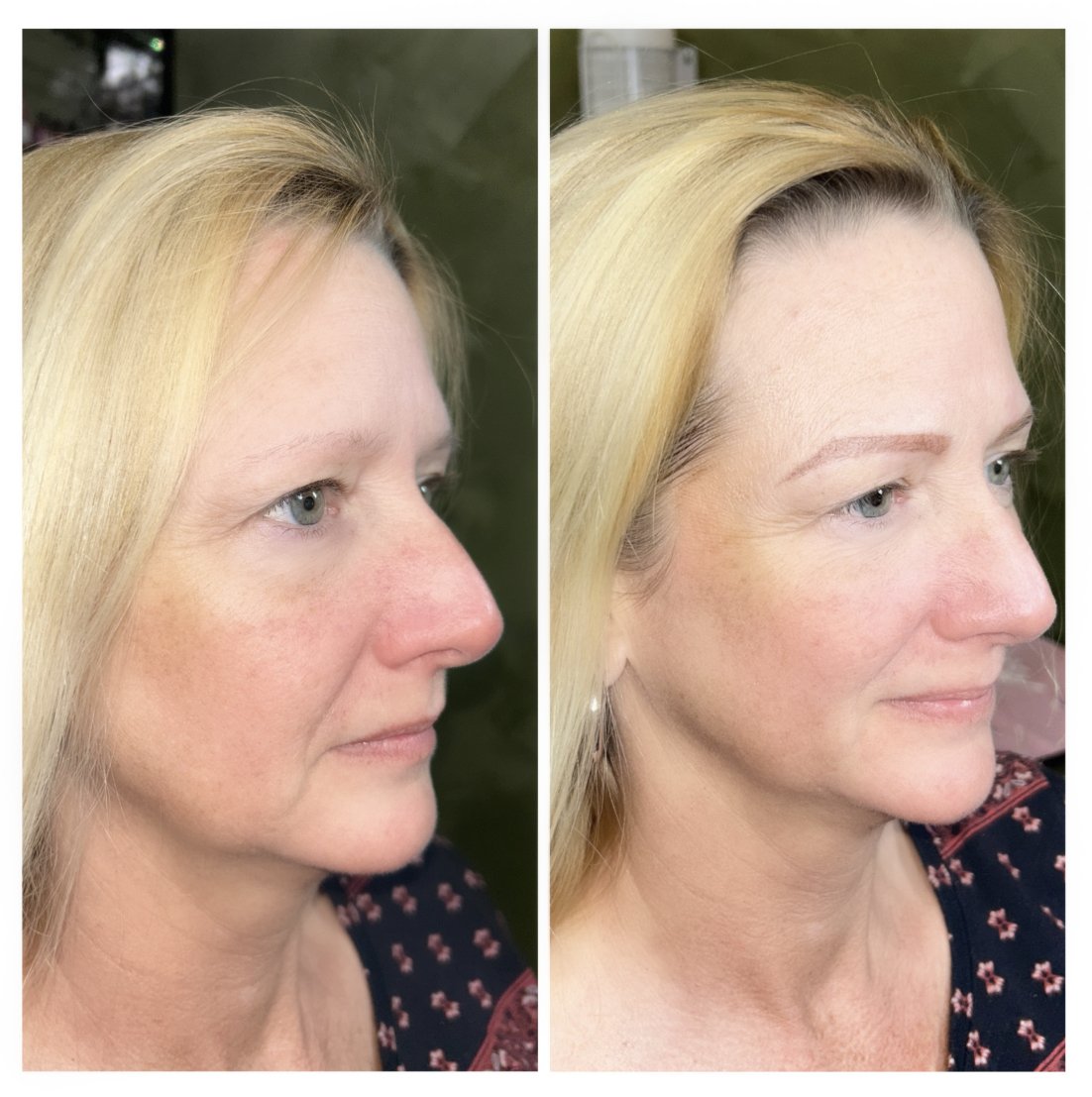 Gallery 3 — The Equator = Tanning, Nails, Permanent Make-up & SMP Scalp ...