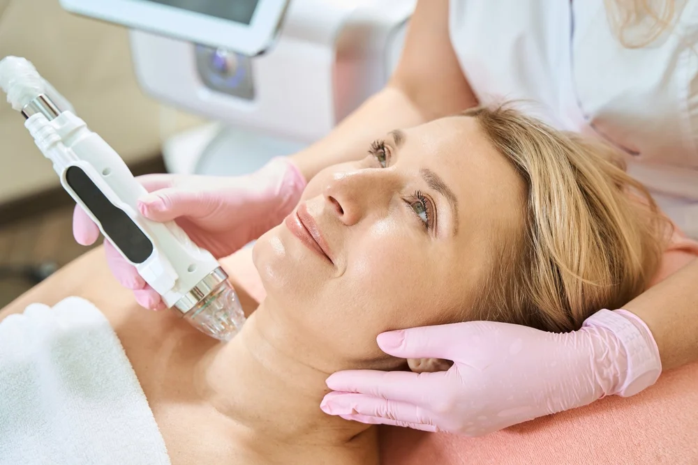 Microneedling - What you Need to Know — Findley Dermatology