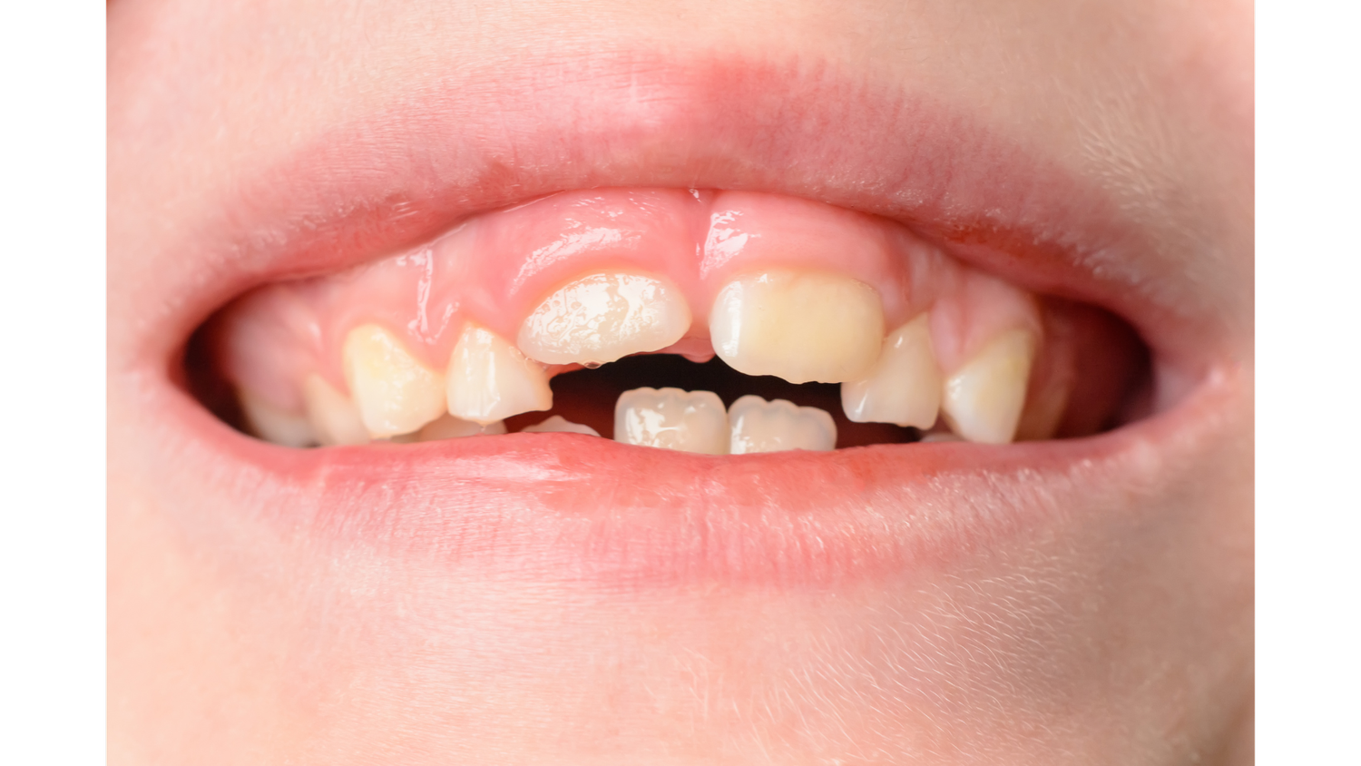 How, Why, and When to Teach Straw Drinking To Your Baby — BabbleBites ...