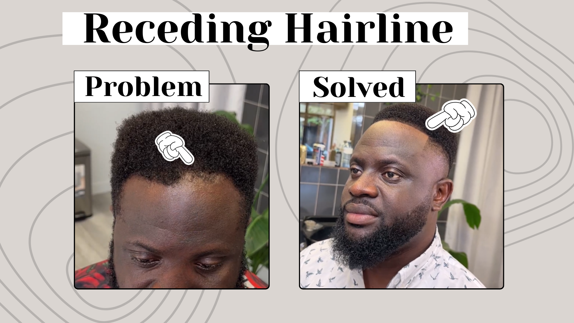 Solving Men's Hair Problems: Receding Hairline, Bald Spots, Patchy Beards — The Rooted Barber ...