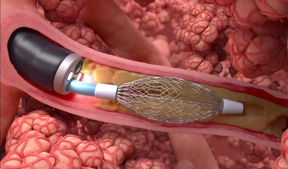 Behandlungen — PulmoCura AG - Lungenmedizin Cham und Lungenklinik Luzern