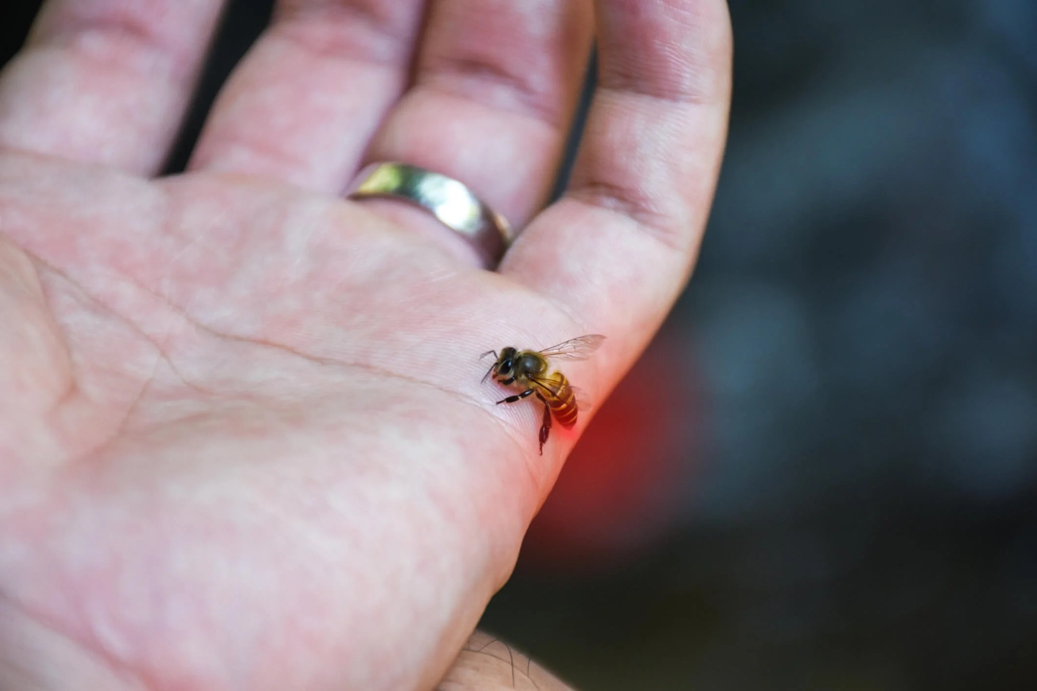 Natural Remedies for Wasp Stings: Fast & Effective Relief