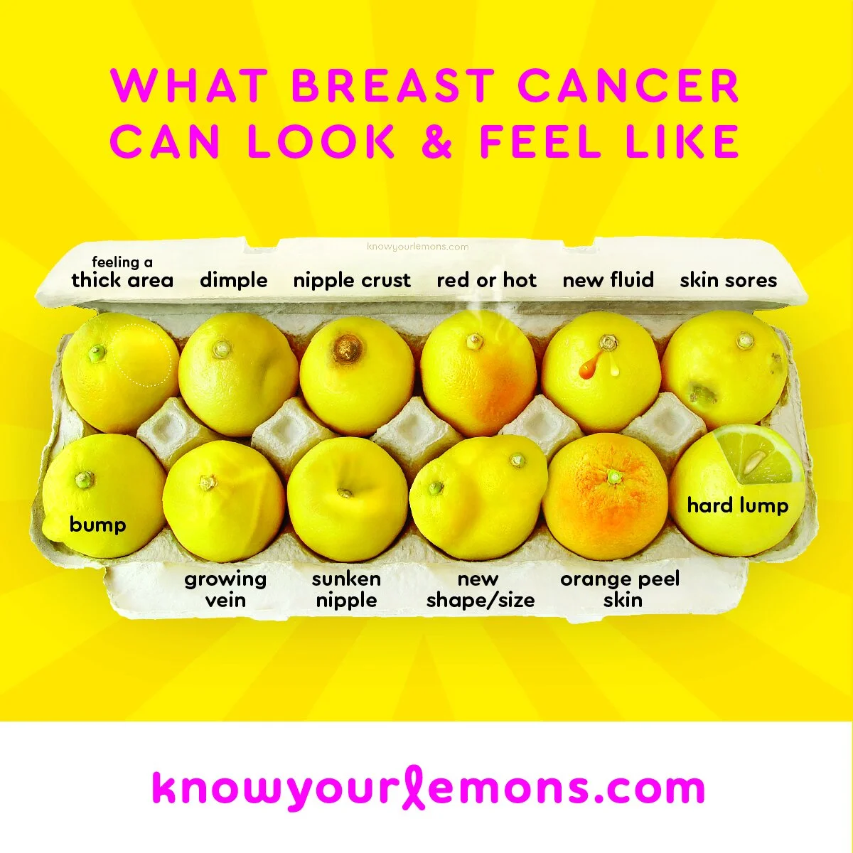 Blog 1 — Know Your Lemons® for Early Detection