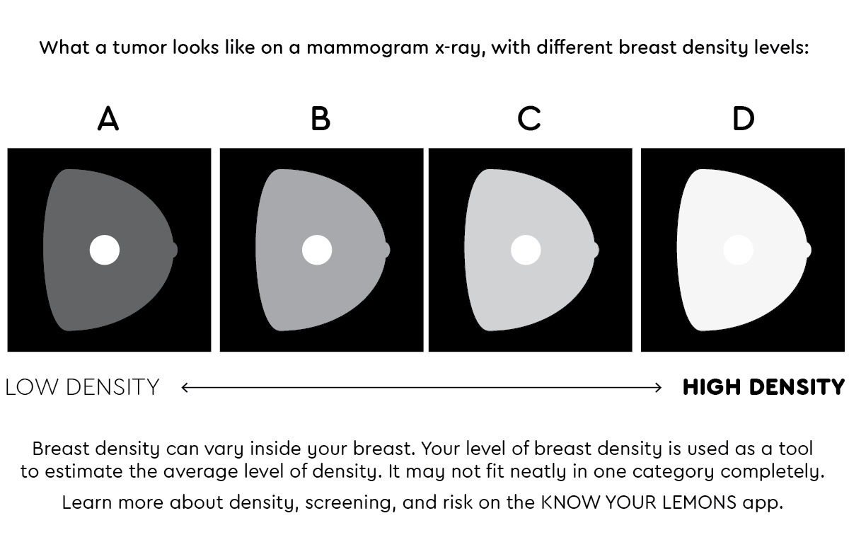 What Is A Mammogram And When To Get A Mammogram — Know Your Lemons® for ...