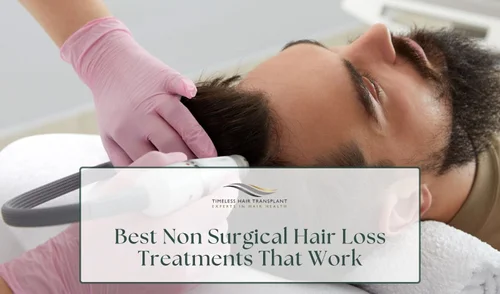 Best Non-Surgical Hair Loss Treatments That Work — Timeless Hair Transplant