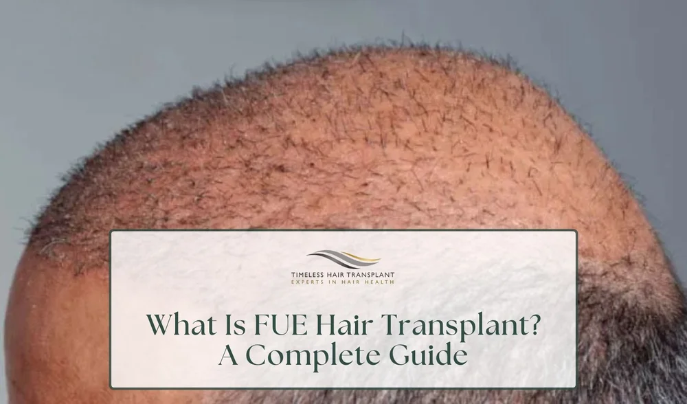 What Is FUE Hair Transplant? A Complete Guide — Timeless Hair Transplant