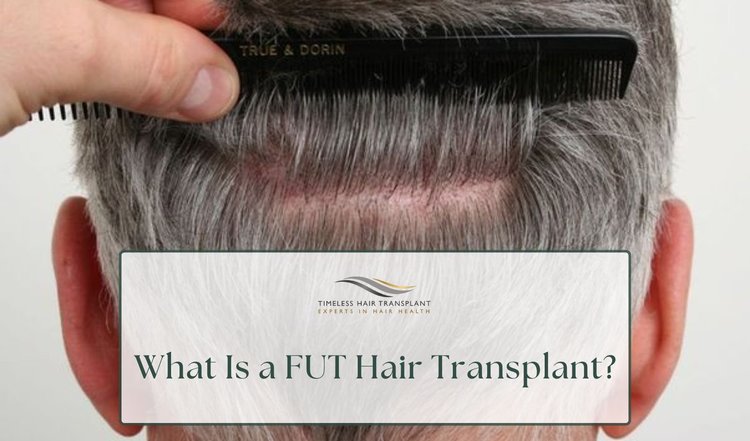 What Is a FUT Hair Transplant? Complete Guide — Timeless Hair Transplant