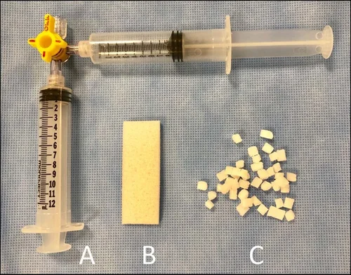 Embolization Materials — Learn IR