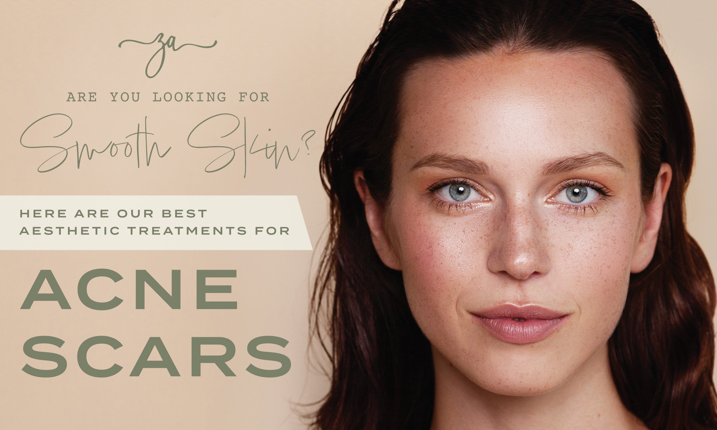 Our 5 Best Aesthetic Treatments For Acne Scars — ZenTox Aesthetics