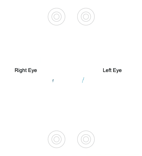 How RightEye Technology Enhances Vestibular Therapy for Dizziness ...