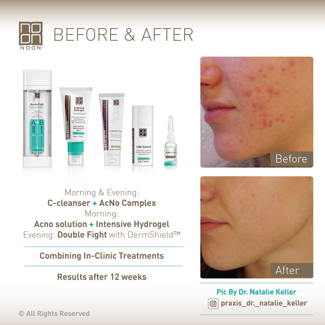 SHOP Noon Aesthetics with Nurse V — Nurse V