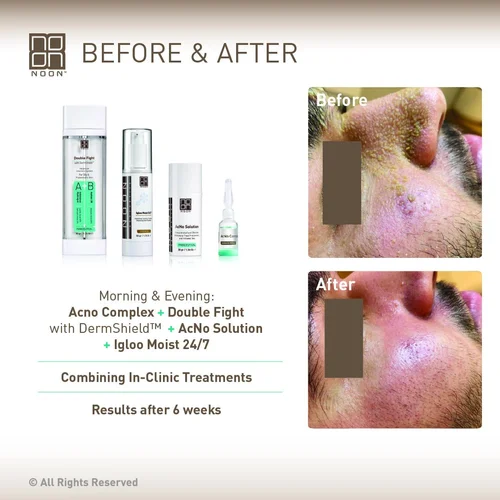 SHOP Noon Aesthetics with Nurse V — Nurse V