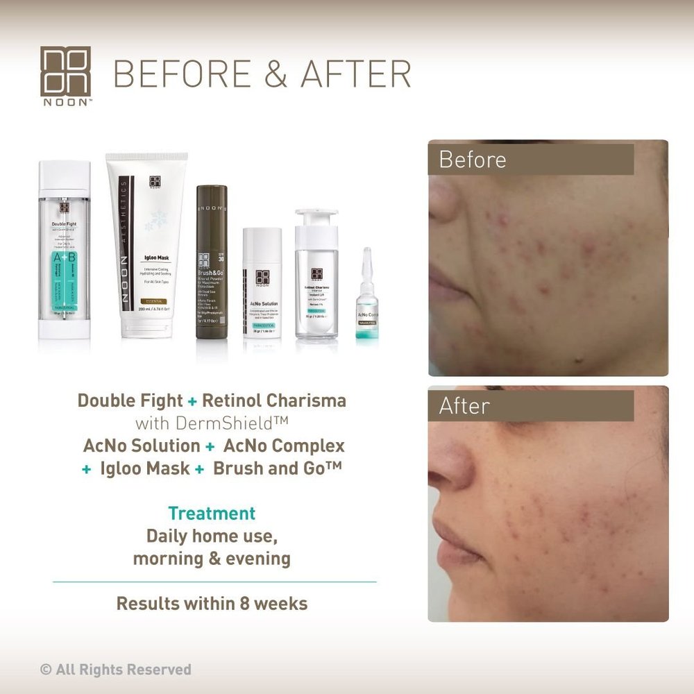 SHOP Noon Aesthetics with Nurse V — Nurse V