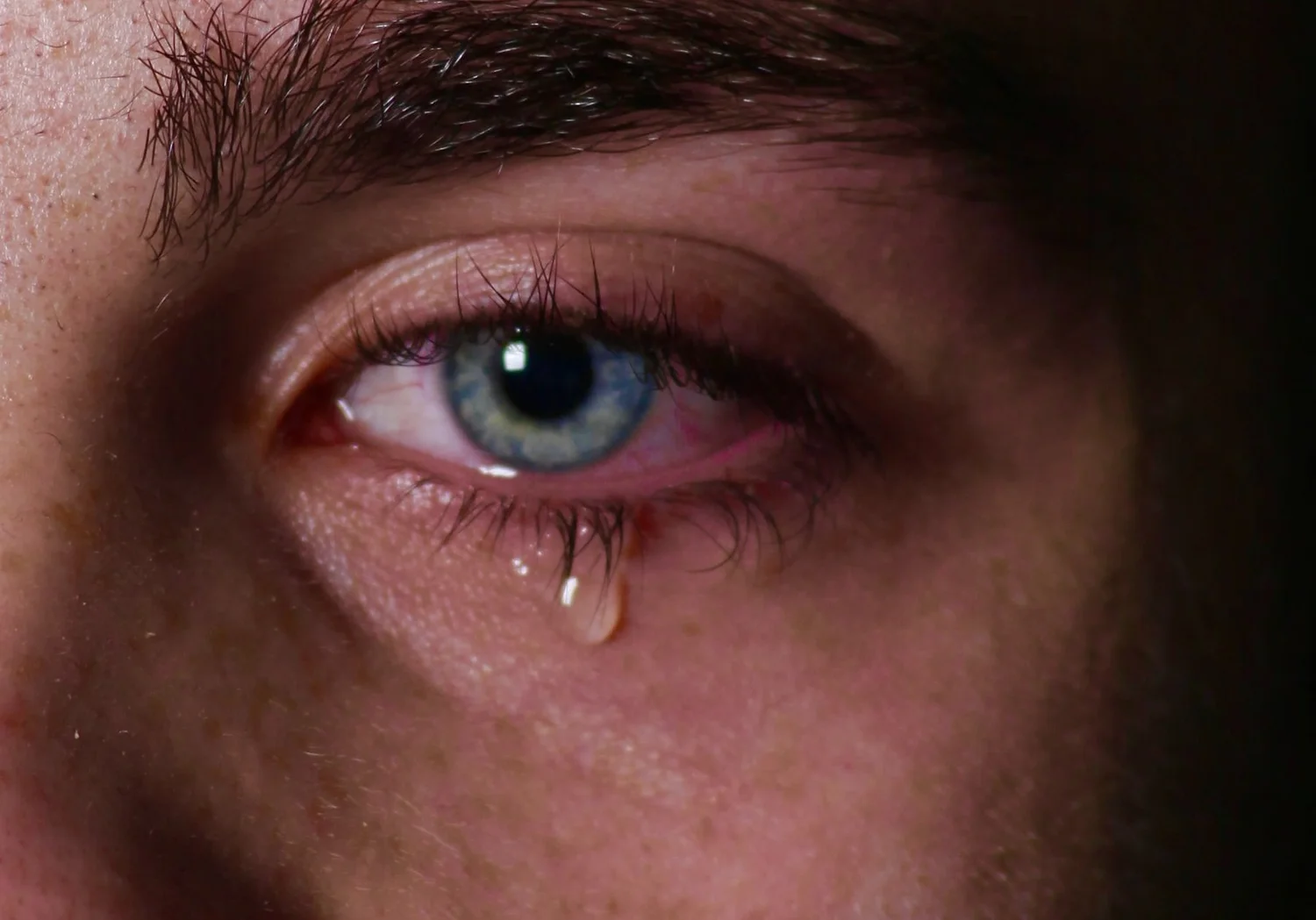 Treatment for Red Watery Eyes - Epiphora Treatment Eye Drops — The SEE ...