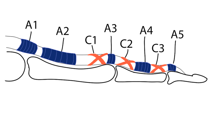 Your Guide: Trigger Fingers and Trigger Thumbs — Dr. Nick Golinvaux