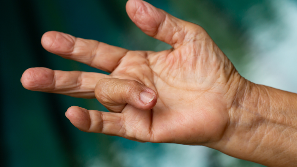 Learn About Hand & Upper Extremity Conditions — Dr. Nick Golinvaux