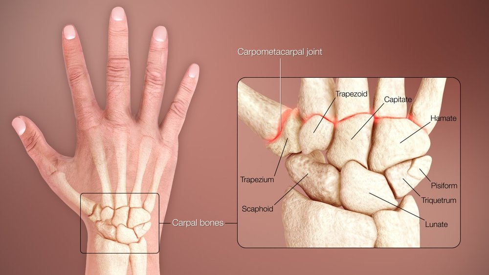 Don’t Ignore Wrist Pain — What To Know About Scaphoid Fractures — Dr ...