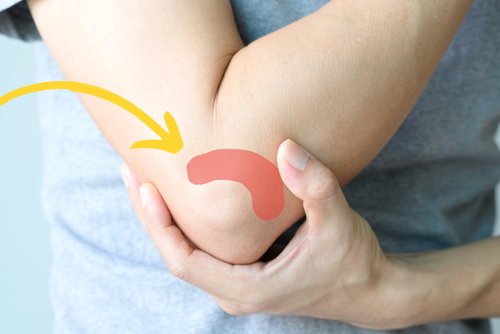 Springtime Elbow (For Many, Pickleball Elbow) — Dr. Nick Golinvaux